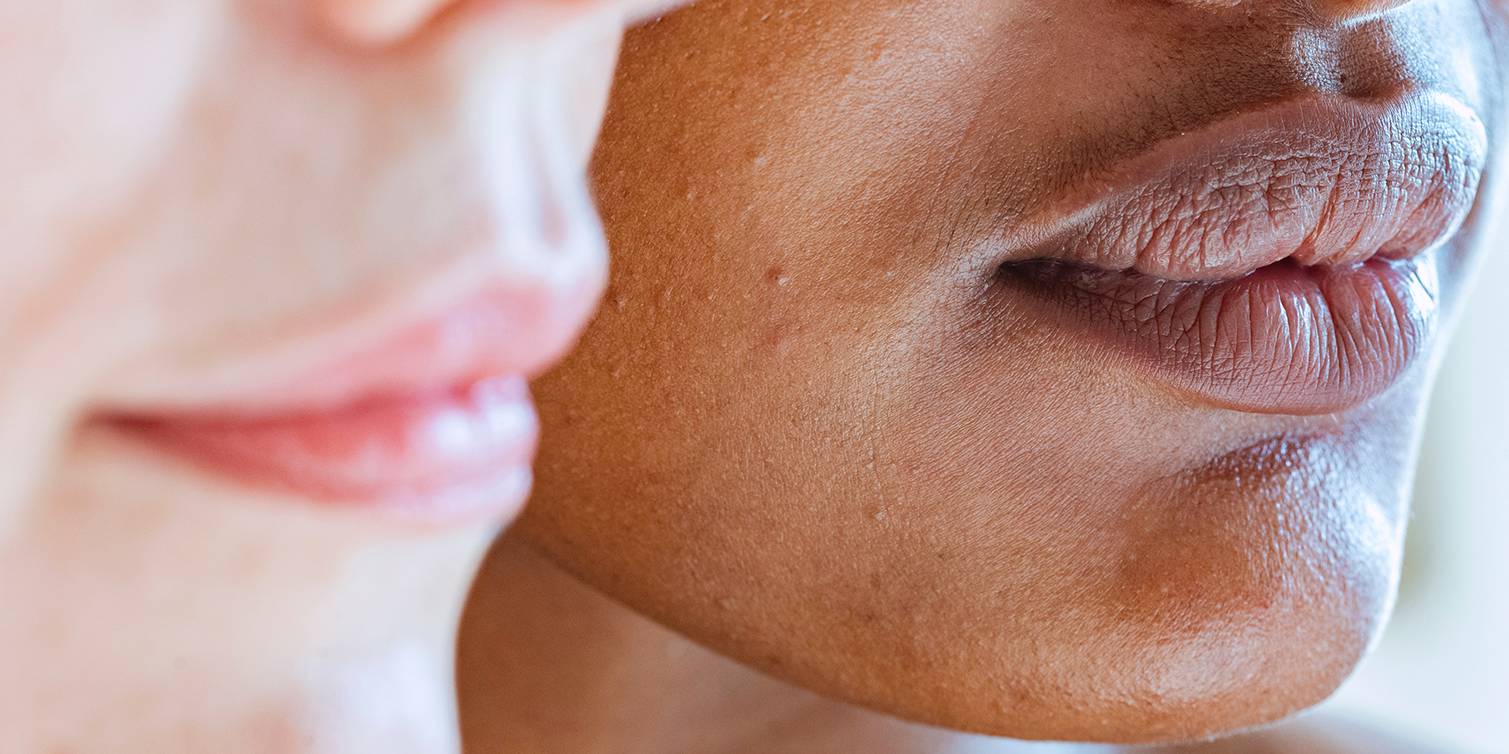 THE IMPORTANCE OF SKIN BARRIER HEALTH - Curated Skin & Wellness